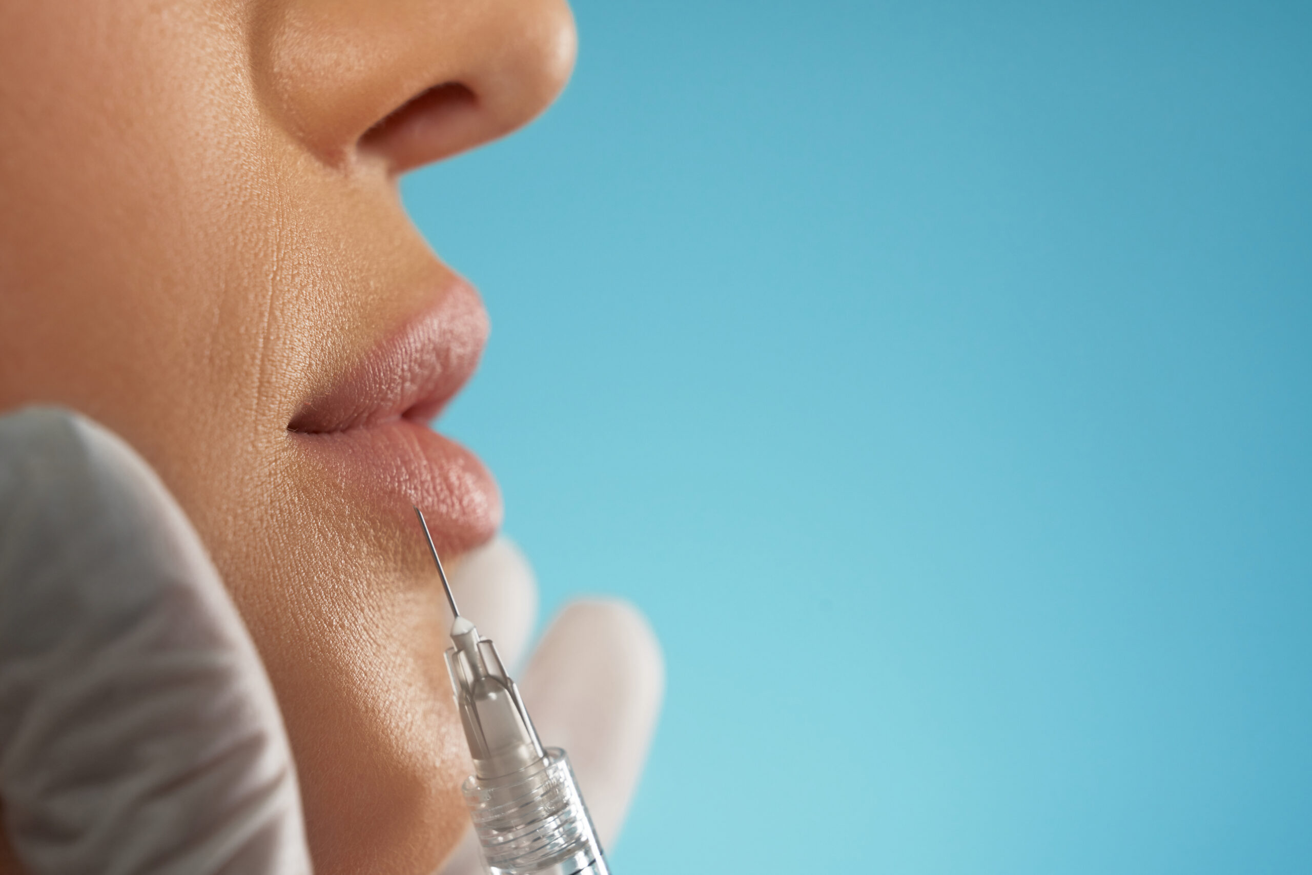 Marire buze cu acid hialuronic in Iasi – rezultate naturale ...
